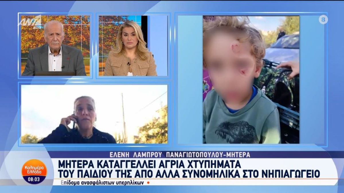 Μητέρα καταγγέλλει άγριο ξυλοδαρμό του παιδιού της στο νηπιαγωγείο ...